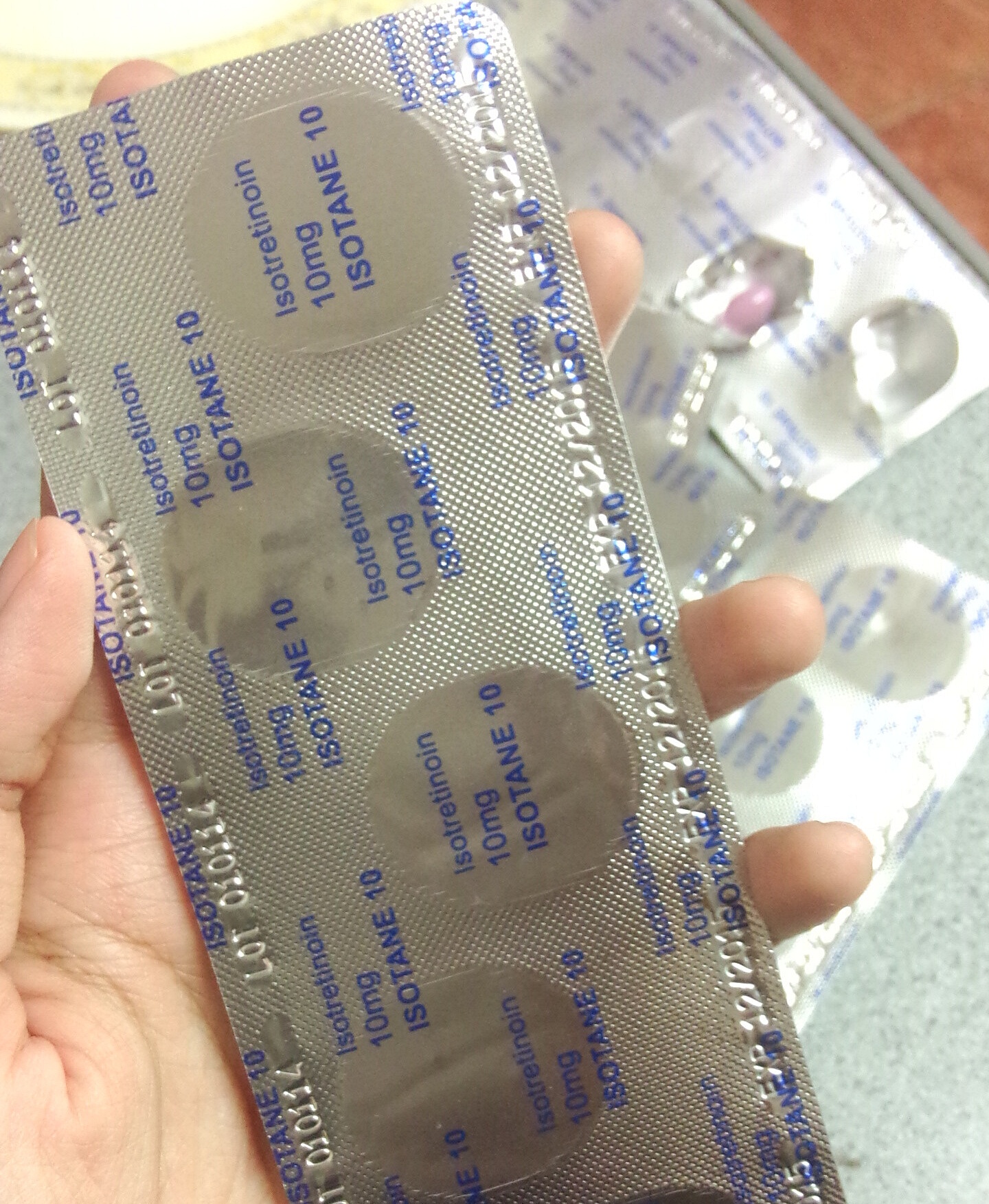 ` แนะนำ - คนหน้ามันที่ใช้อะไรก็ไม่หายซักที | สุขภาพและความงาม | 4040658